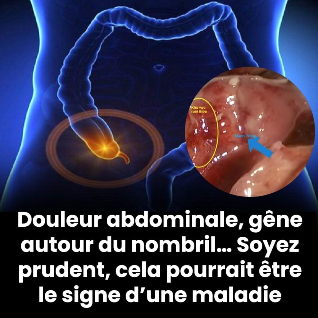 Douleurs abdominales : Identifier les signaux d'alerte autour du ...